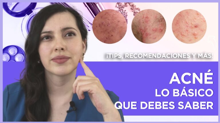 ¿Cómo detectar el acné comedogénico?